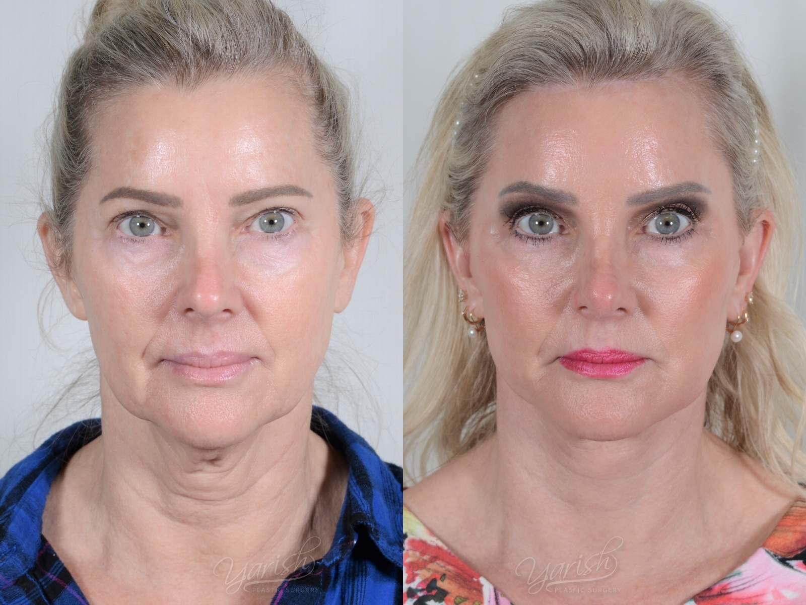 New Moisturizer That Removes The Signs Of Ageing Gets Biggest Deal In The Investors Reality Tv